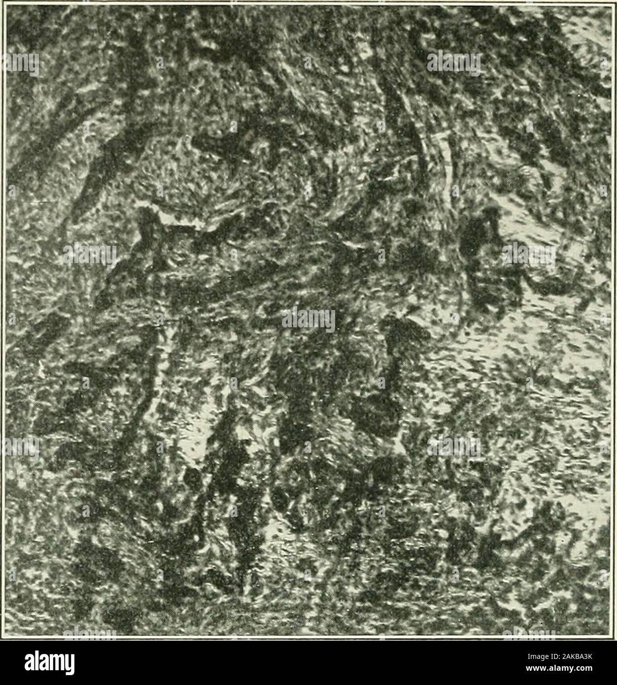 Scar study hi-res stock photography and images - Alamy