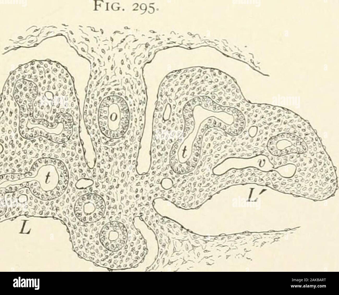 Bronchial tree division hi-res stock photography and images - Alamy