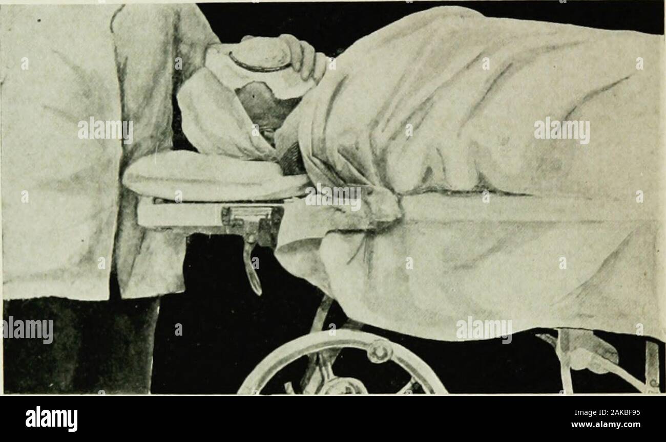 The art of anaesthesia . eopen method so modified that the ...