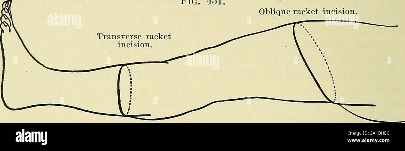A manual of modern surgery : an exposition of the accepted doctrines ...