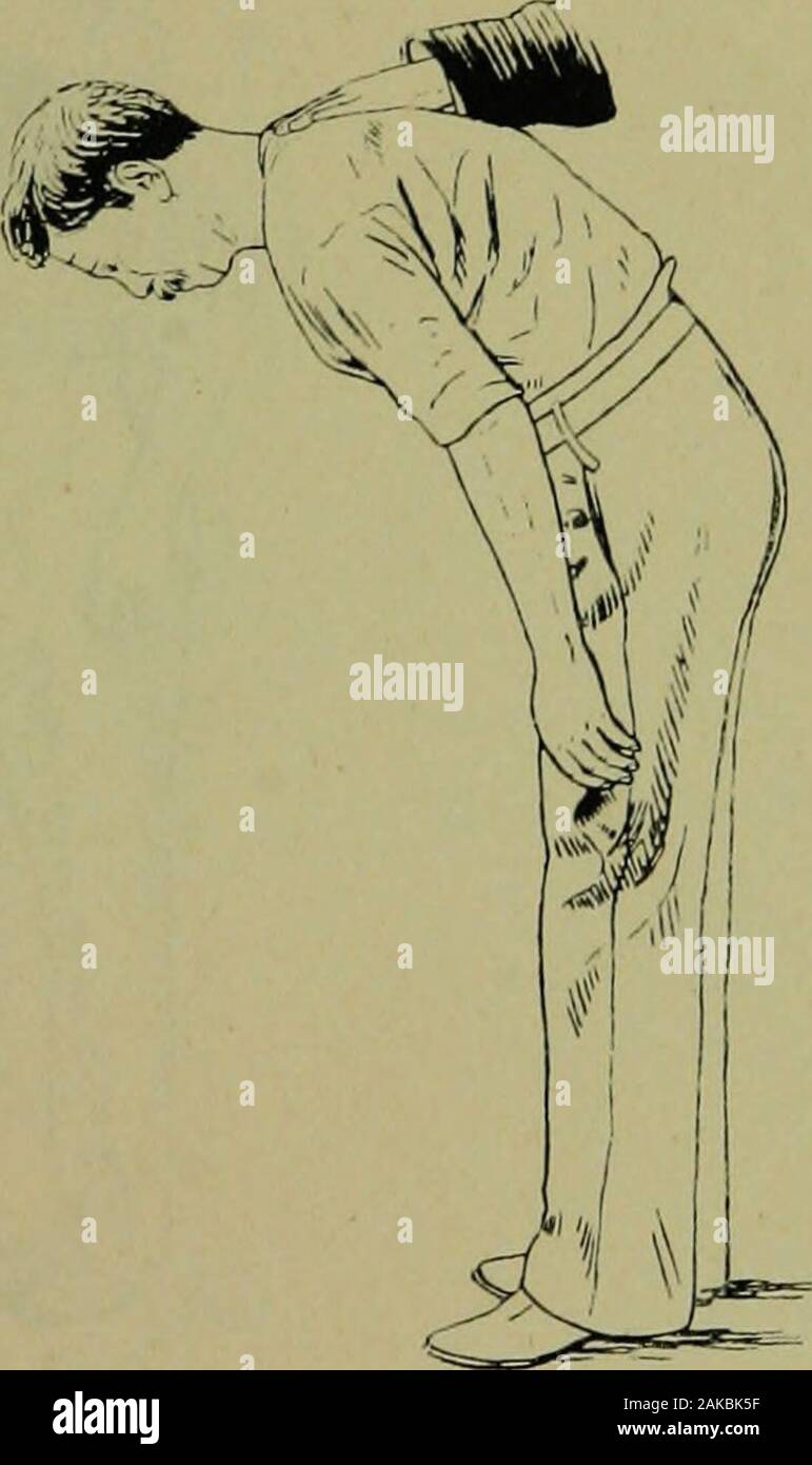 Dorsal side stands hi-res stock photography and images - Alamy