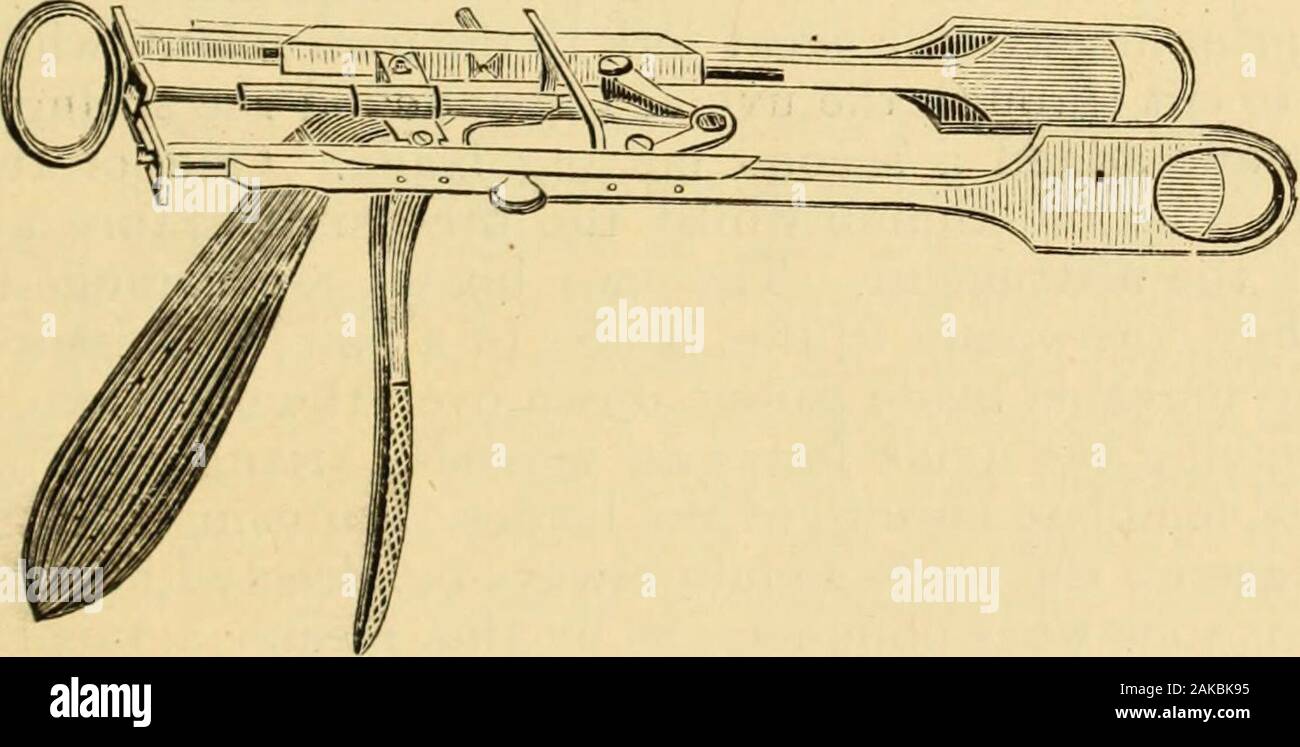 Tonsillotome hi-res stock photography and images - Alamy
