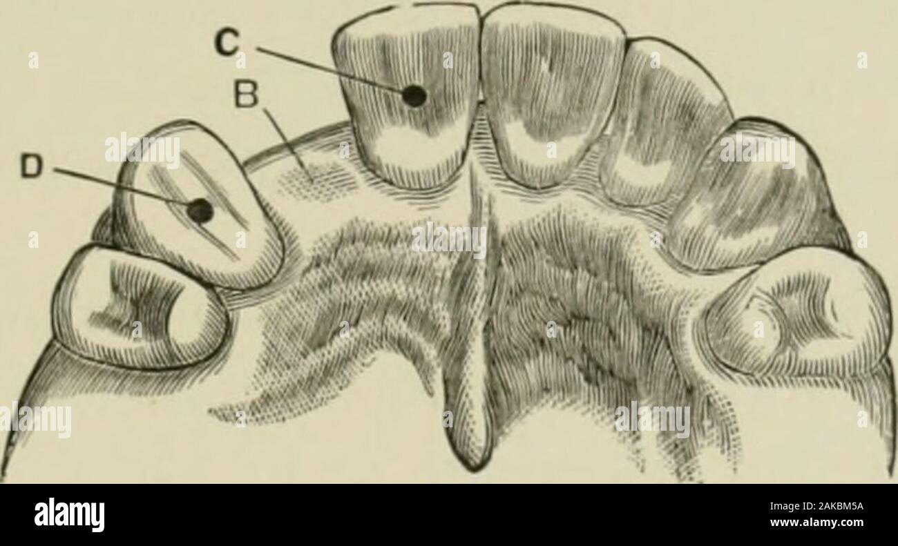 Thinner tooth hi-res stock photography and images - Alamy