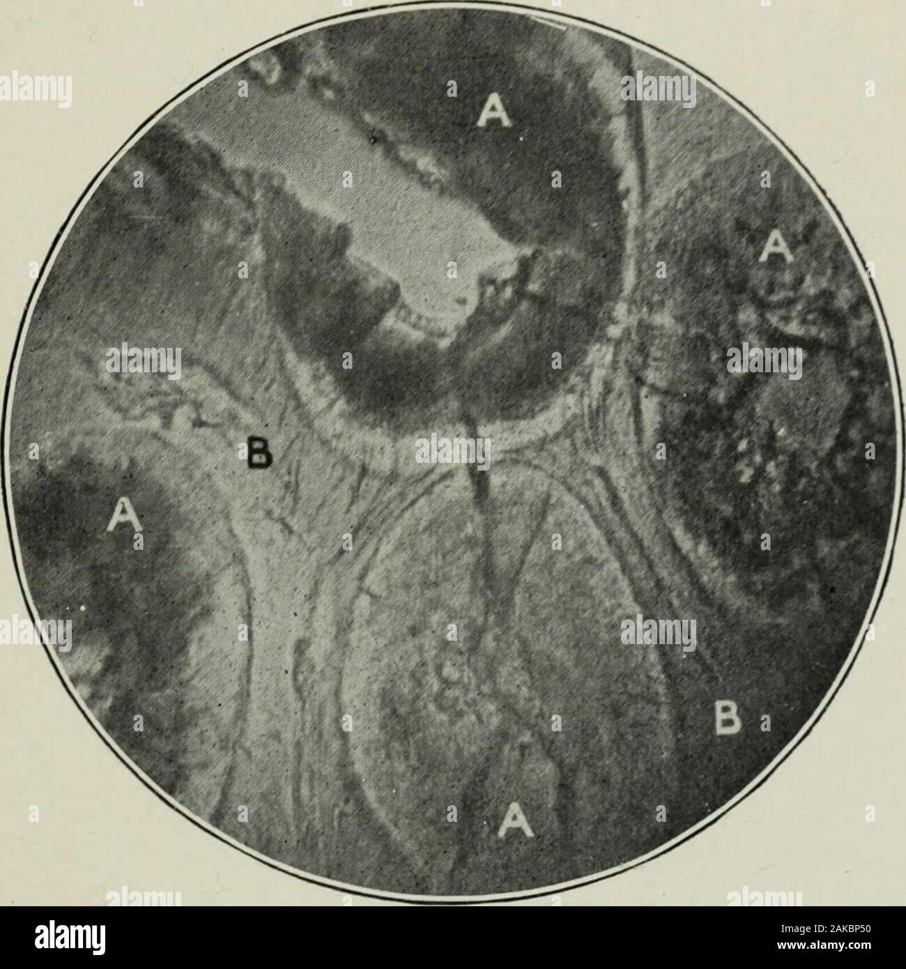 Tooth enamel microscope hi-res stock photography and images - Alamy