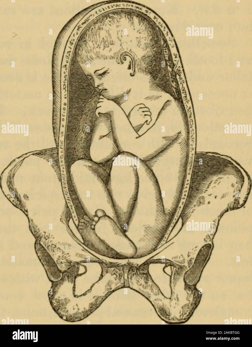 A System of midwifery : including the diseases of pregnancy and the ...