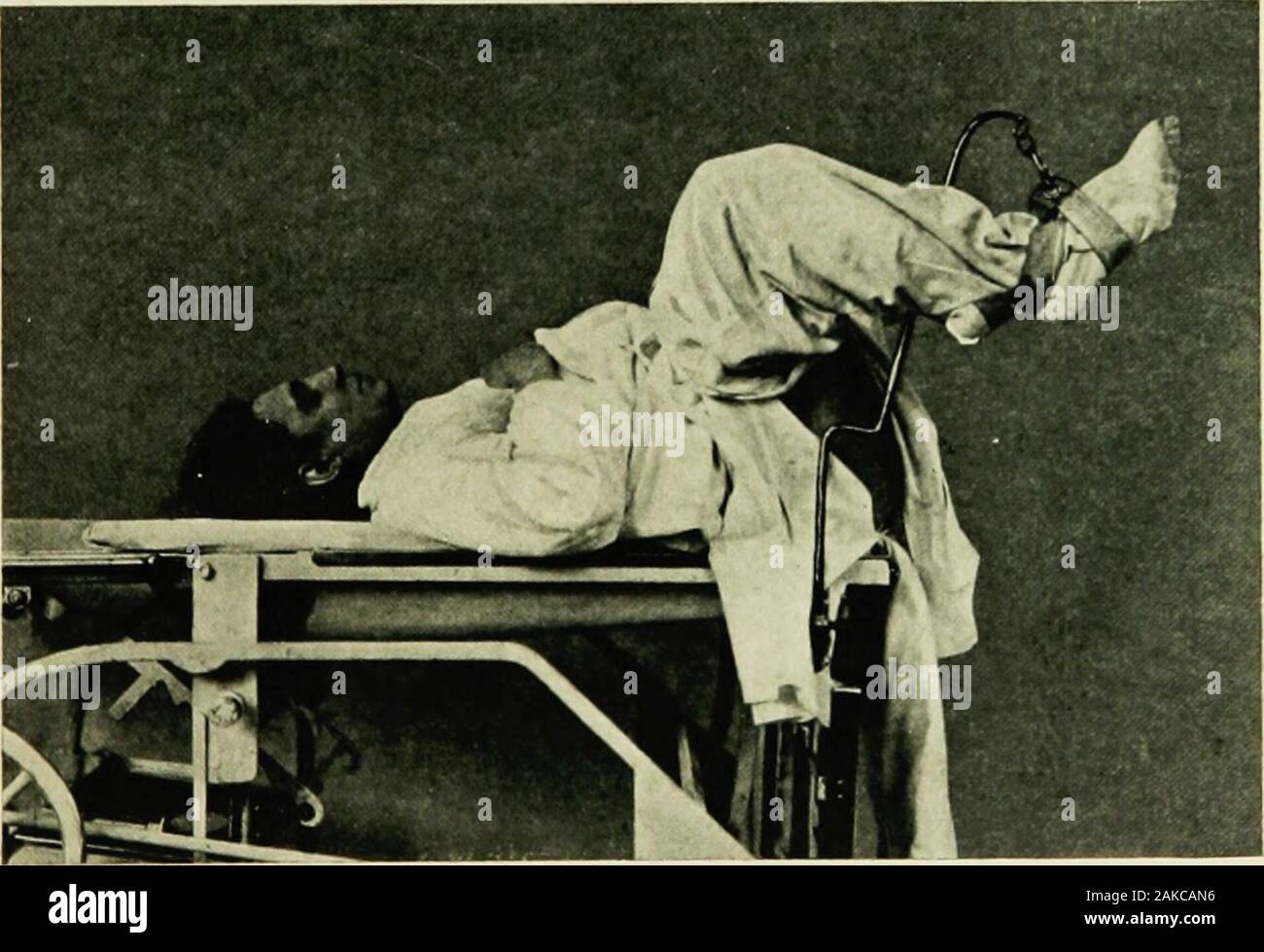 The art of anaesthesia . Fig. 40.—Table get for lithotomy.. Fig. 41 ...