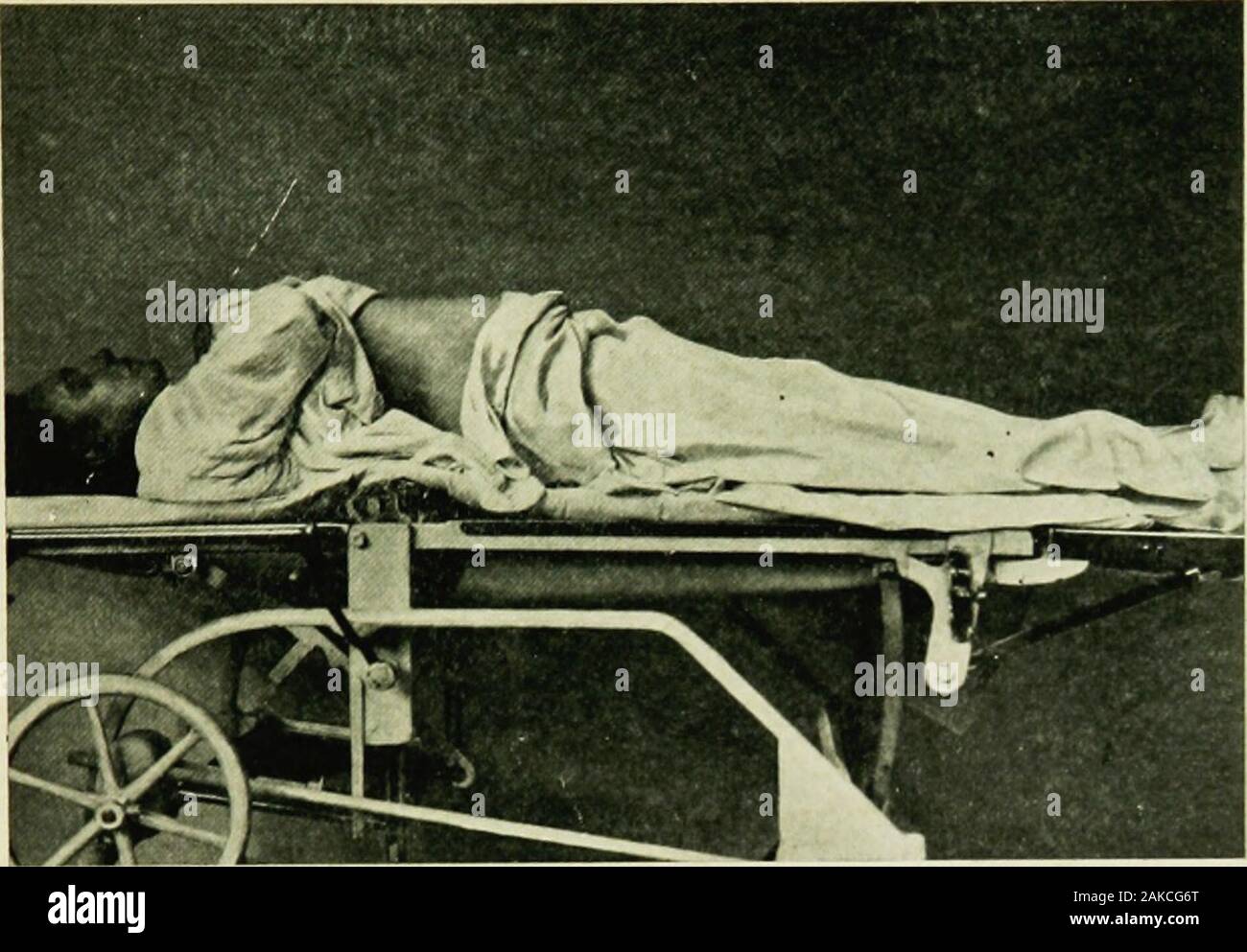Lithotomy position hi-res stock photography and images - Alamy