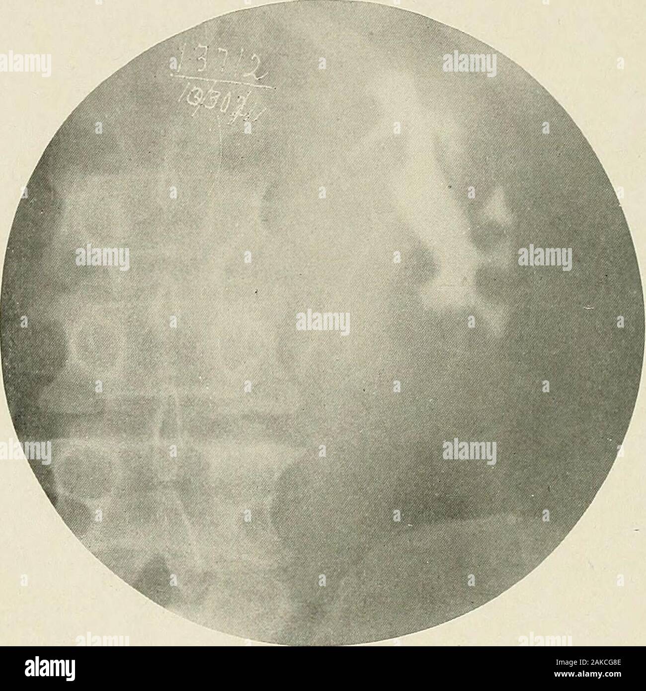 Pyelography (pyelo-ureterography) a study of the normal and pathologic ...