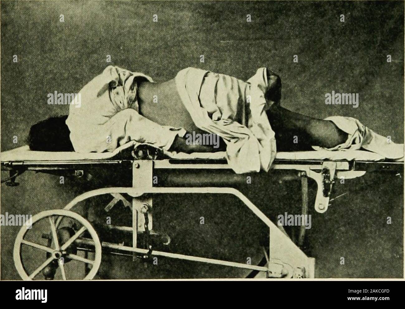 Bladder rack hi-res stock photography and images - Alamy