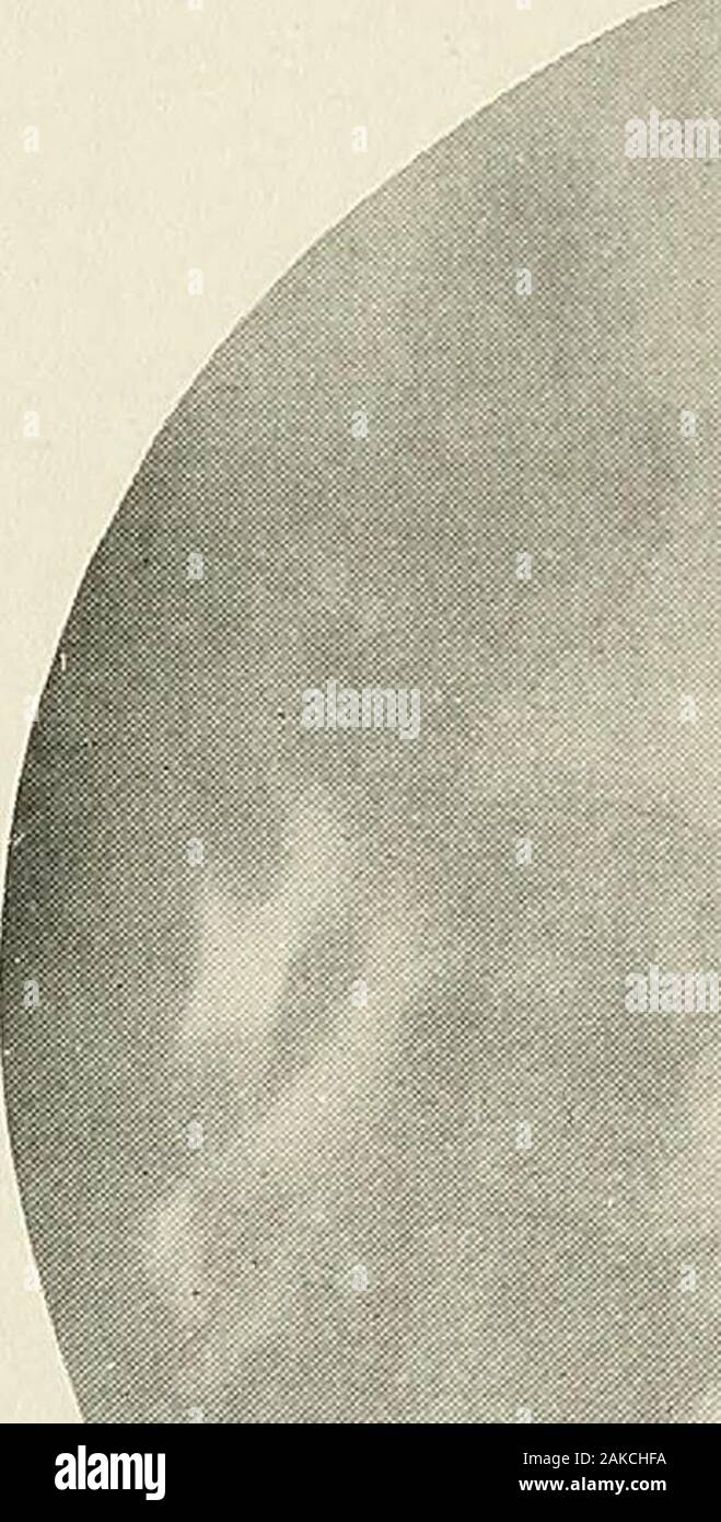 Pyelography (pyelo-ureterography) a study of the normal and pathologic ...