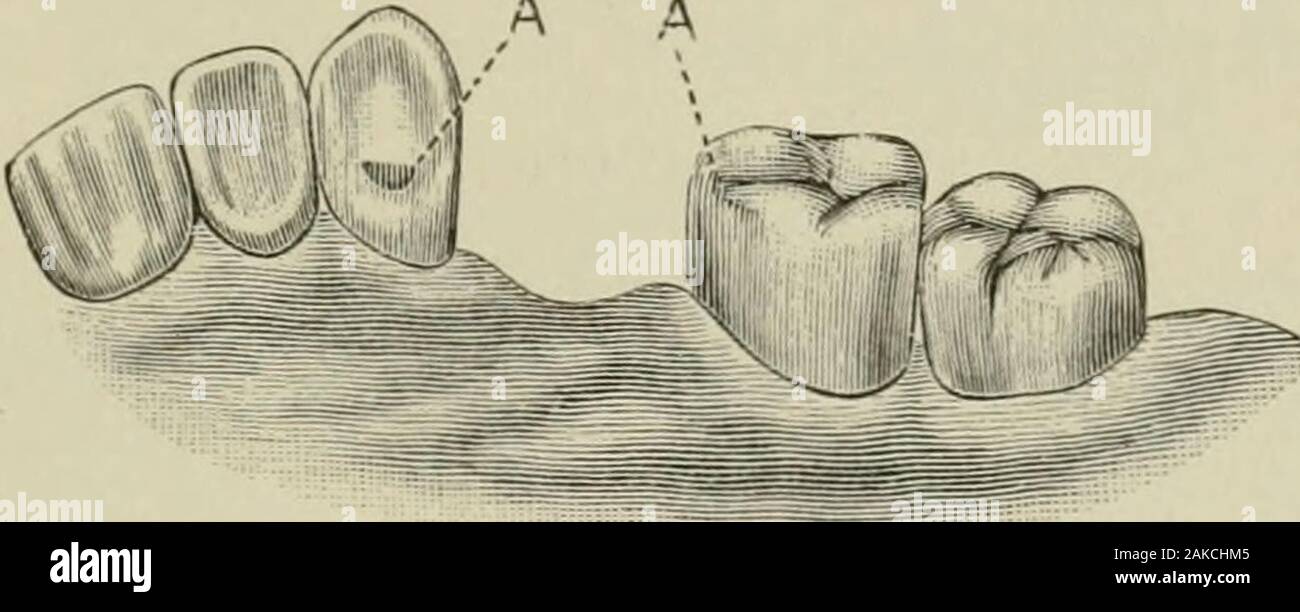 Distal section hi-res stock photography and images - Alamy