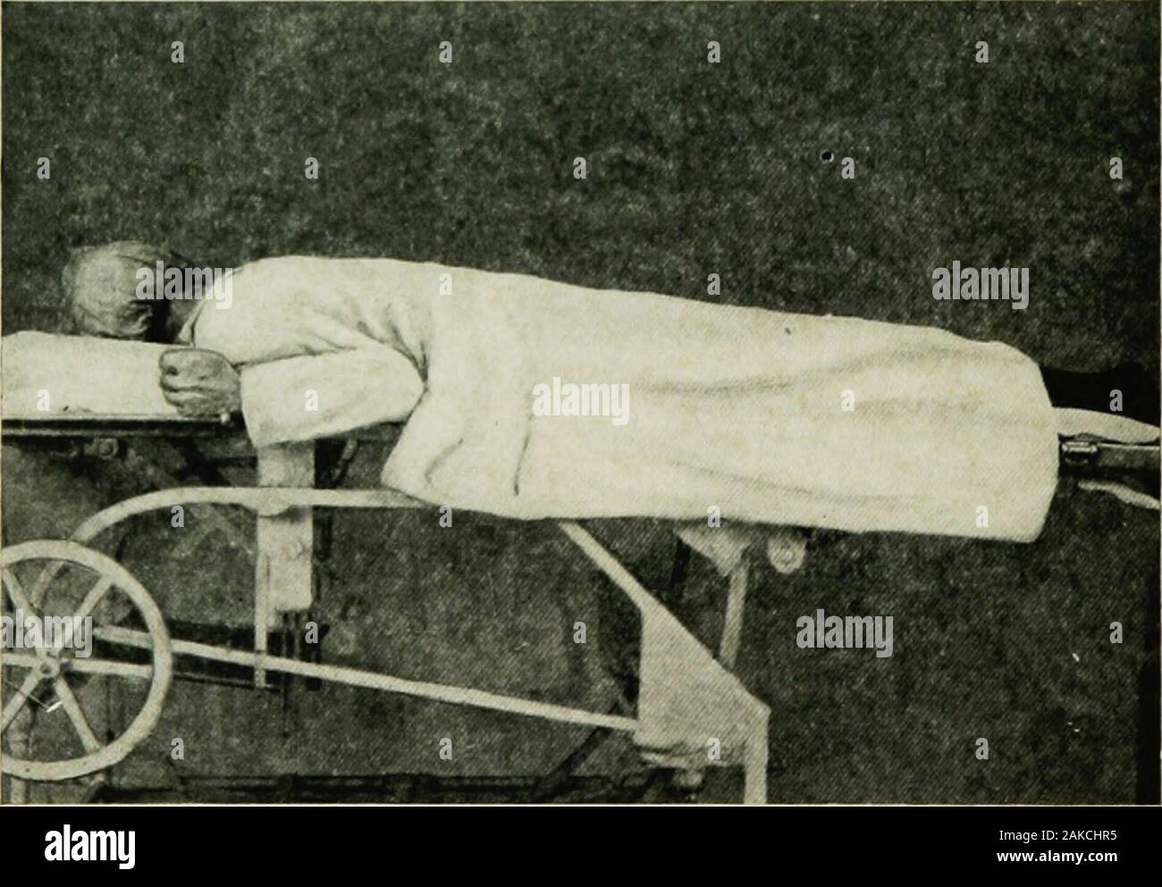 The art of anaesthesia . Fig. 24 —Position for exploration of knee ...