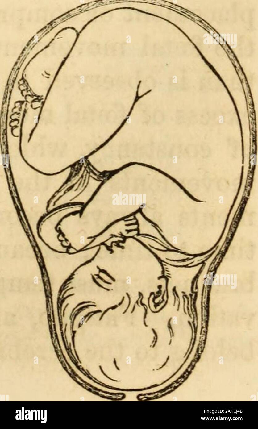 The obstetric memoirs and contributions of James YSimpson; . y eight ...