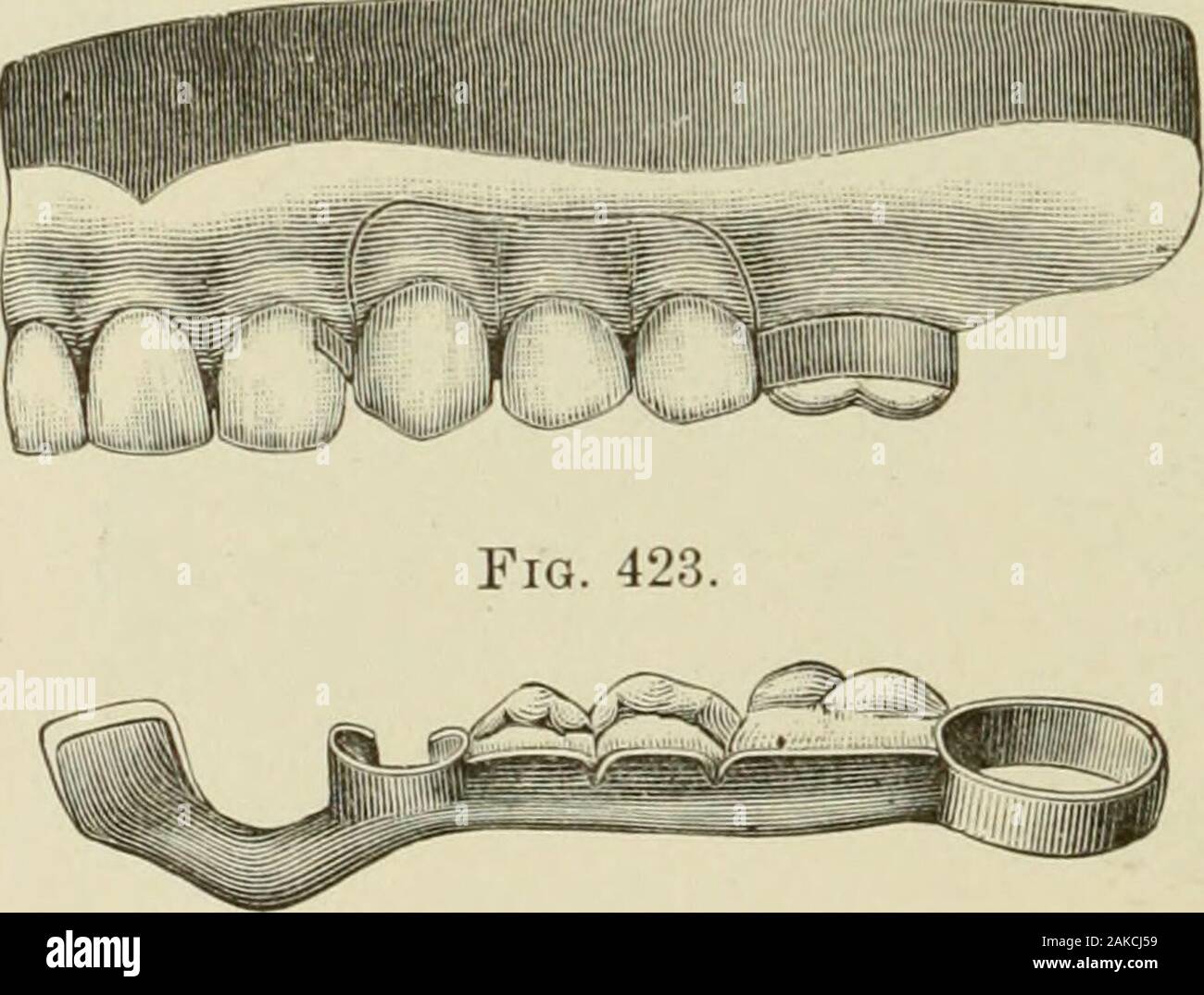 Distal section hi-res stock photography and images - Alamy