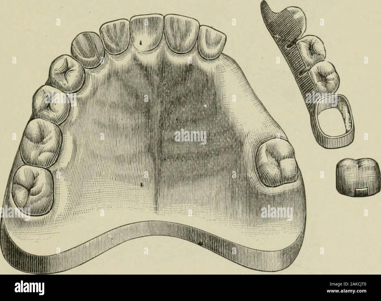 Vulcanite denture hi-res stock photography and images - Alamy