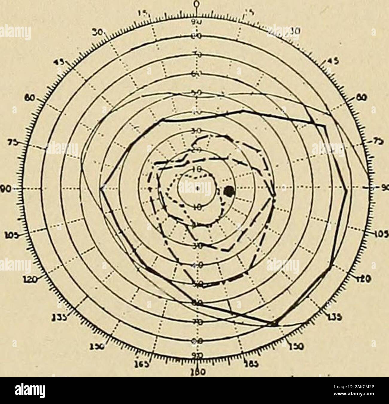 Scotoma hi-res stock photography and images - Alamy