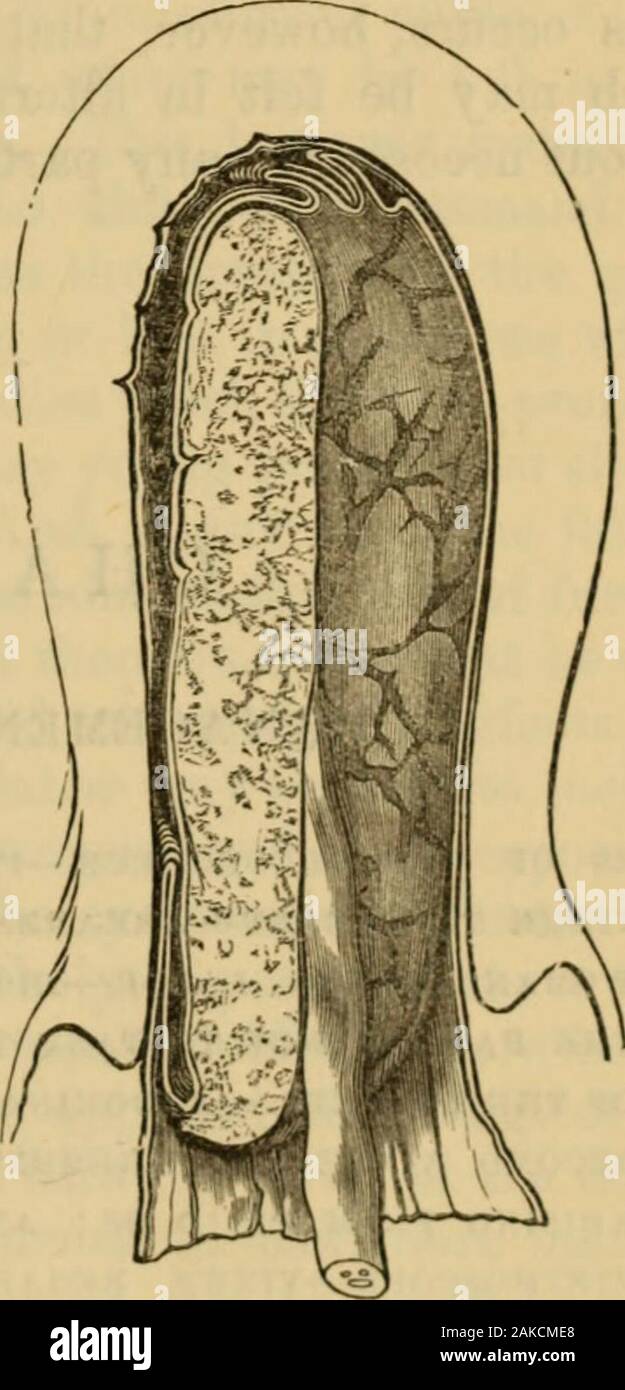 A System of midwifery : including the diseases of pregnancy and the ...