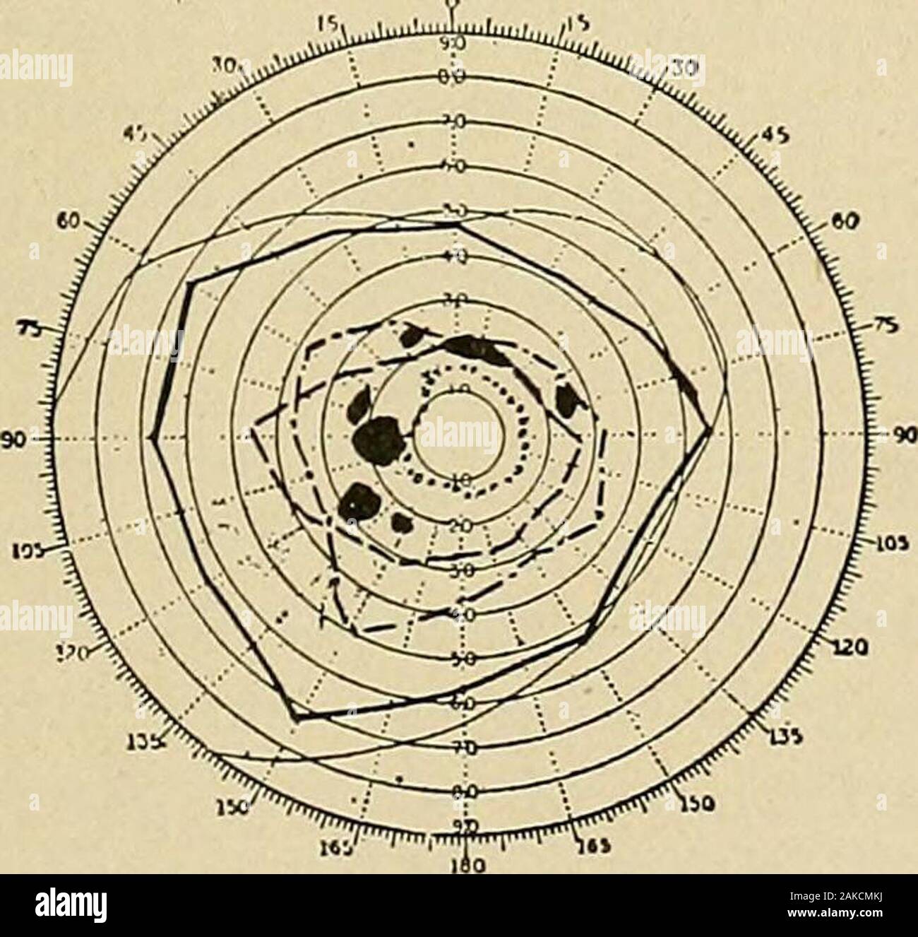 Diseases of the nervous system : a text-book of neurology and ...