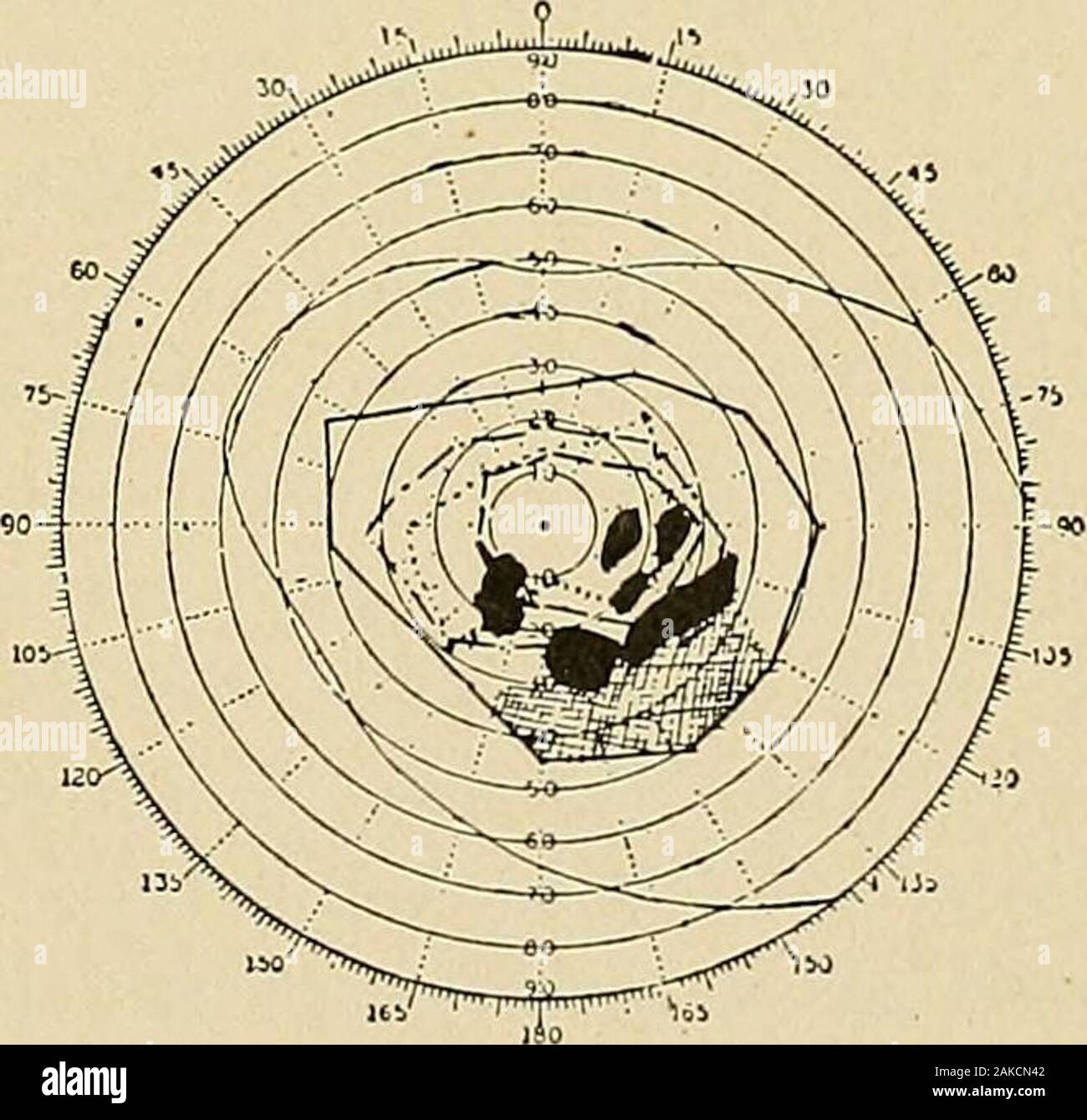 Diseases of the nervous system : a text-book of neurology and ...