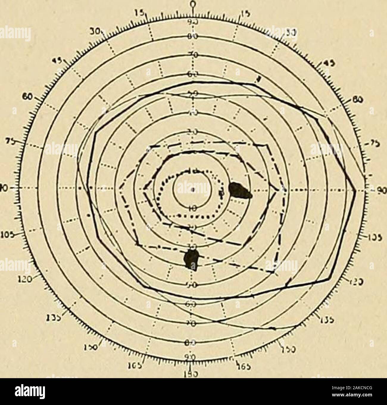 Diseases of the nervous system : a text-book of neurology and ...