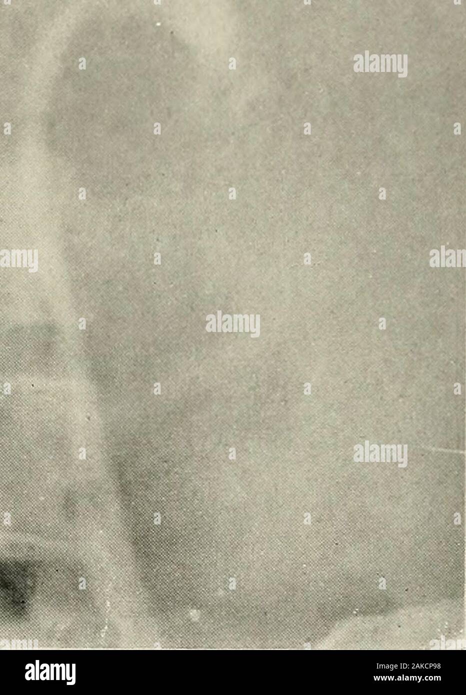 Pyelography (pyelo-ureterography) a study of the normal and pathologic ...