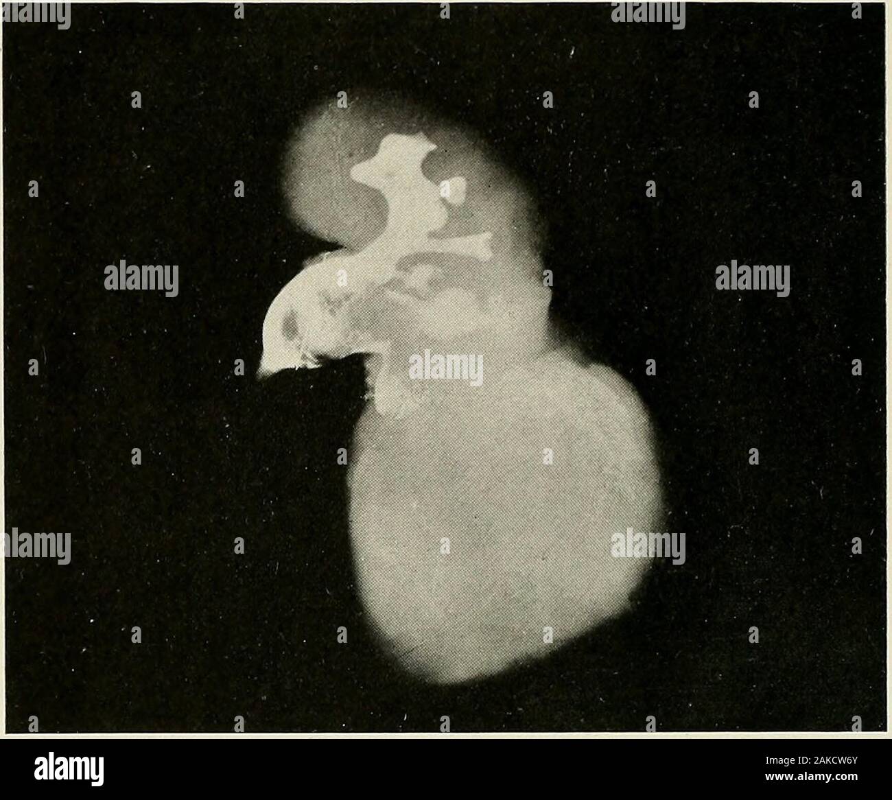 Pyelography (pyelo-ureterography) a study of the normal and pathologic ...