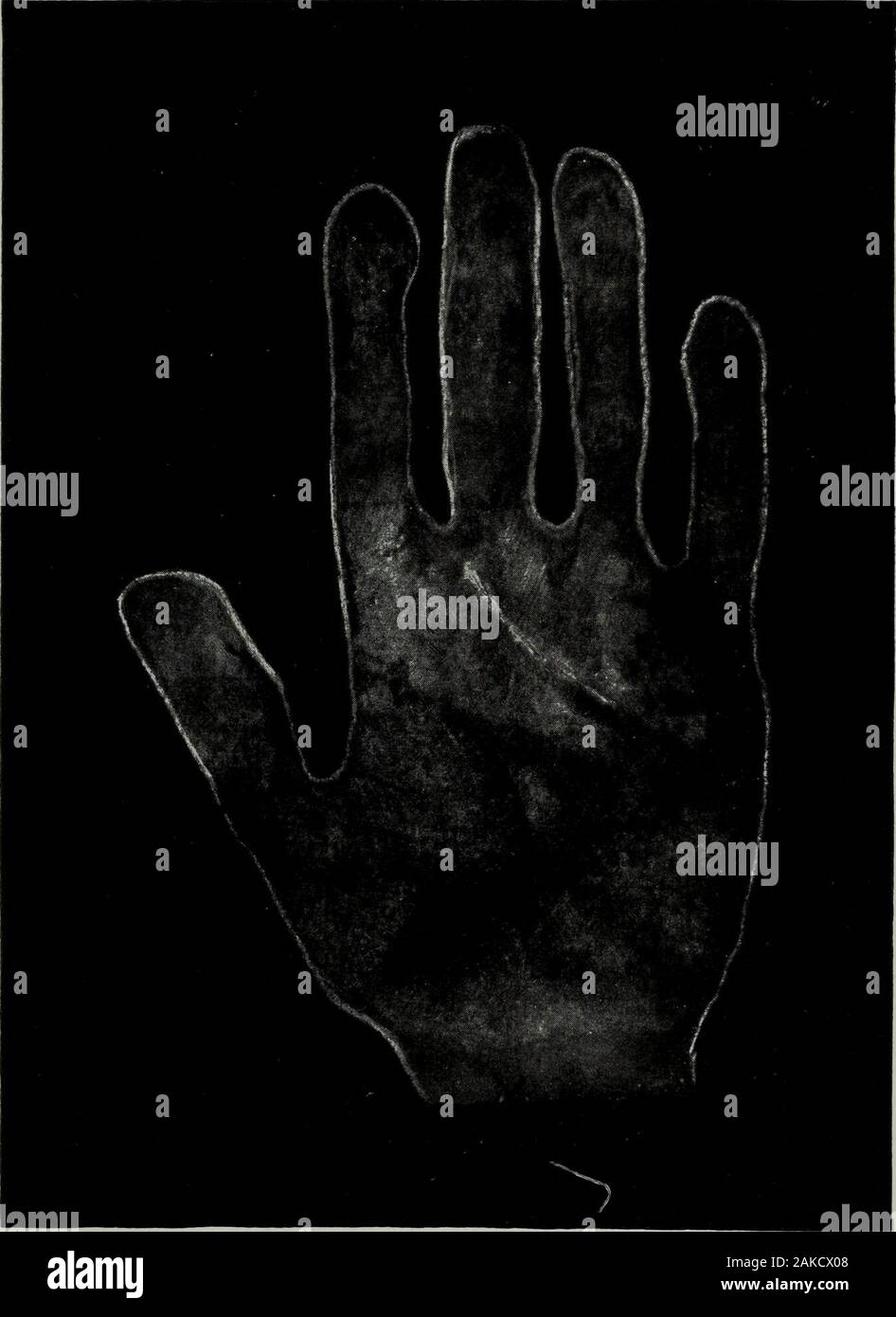 Perin's science of palmistry; a complete and authentic treatise . THE ...