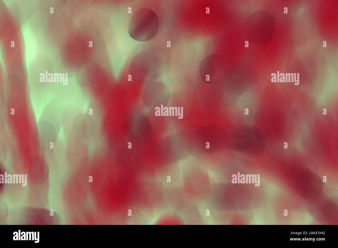 Mrsa microscope hi-res stock photography and images - Alamy