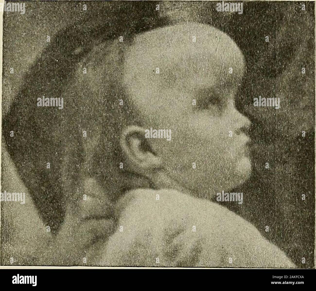 Pediatrics : the hygienic and medical treatment of children . y, or ...