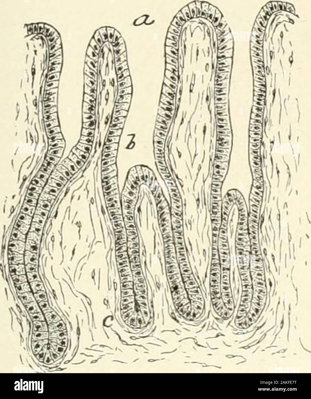 Adenoid tissue hi-res stock photography and images - Alamy