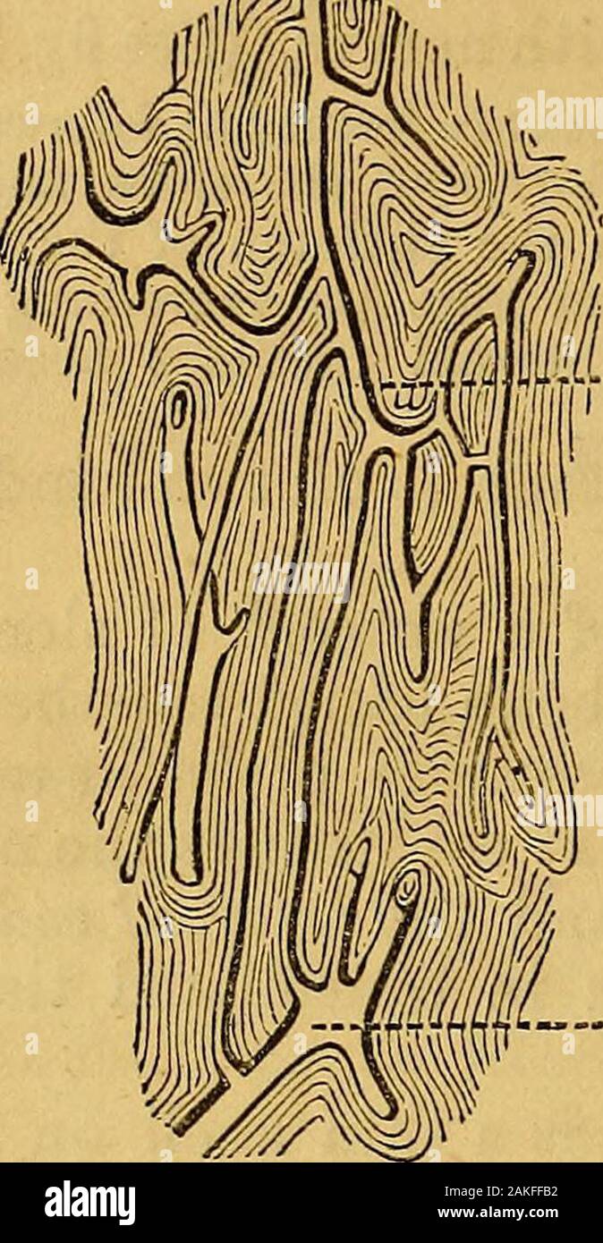 Longitudinal section of bone hi-res stock photography and images - Alamy