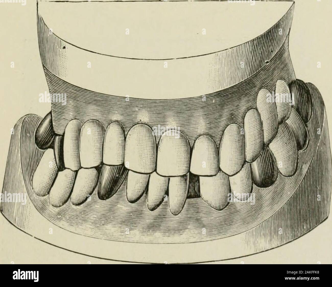 Pulpless hi-res stock photography and images - Alamy