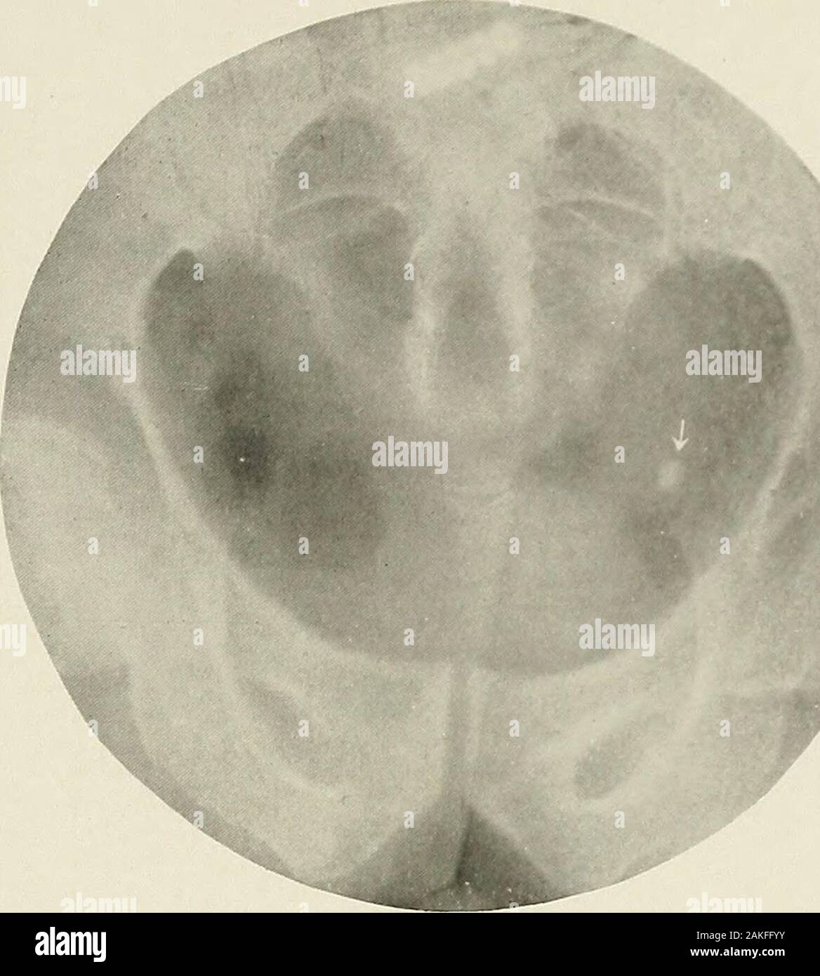 Pyelography (pyelo-ureterography) a study of the normal and pathologic ...