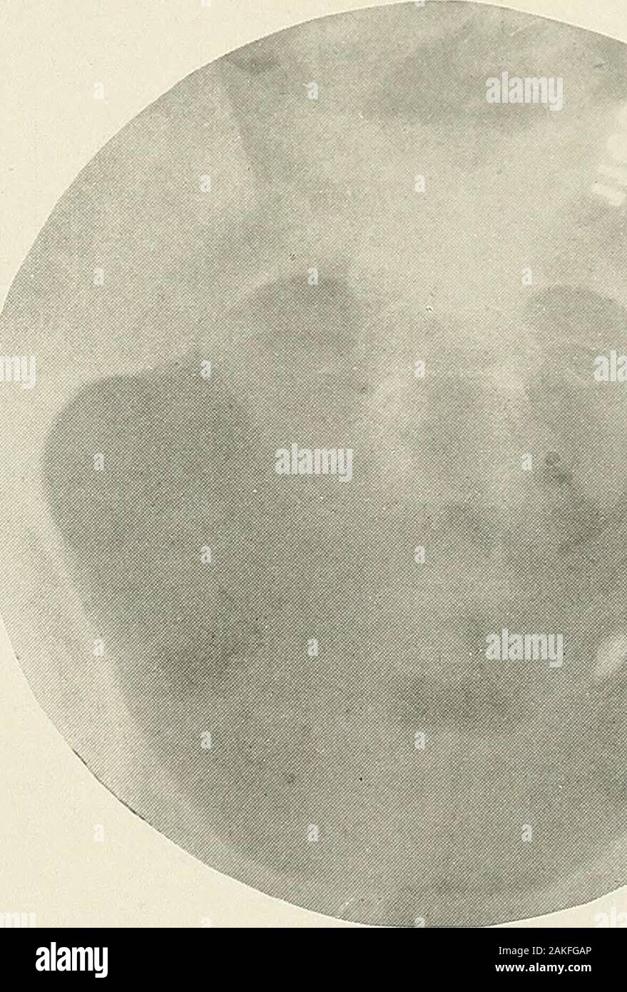 Pyelography (pyelo-ureterography) a study of the normal and pathologic ...