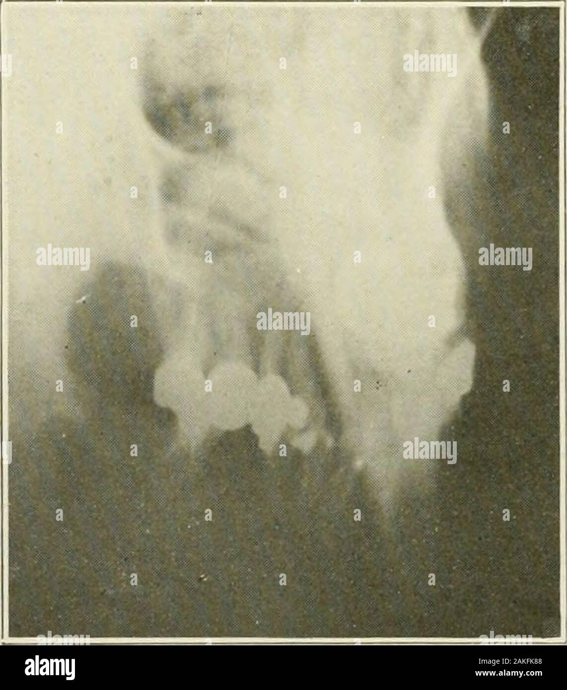 Rarefying hi-res stock photography and images - Alamy