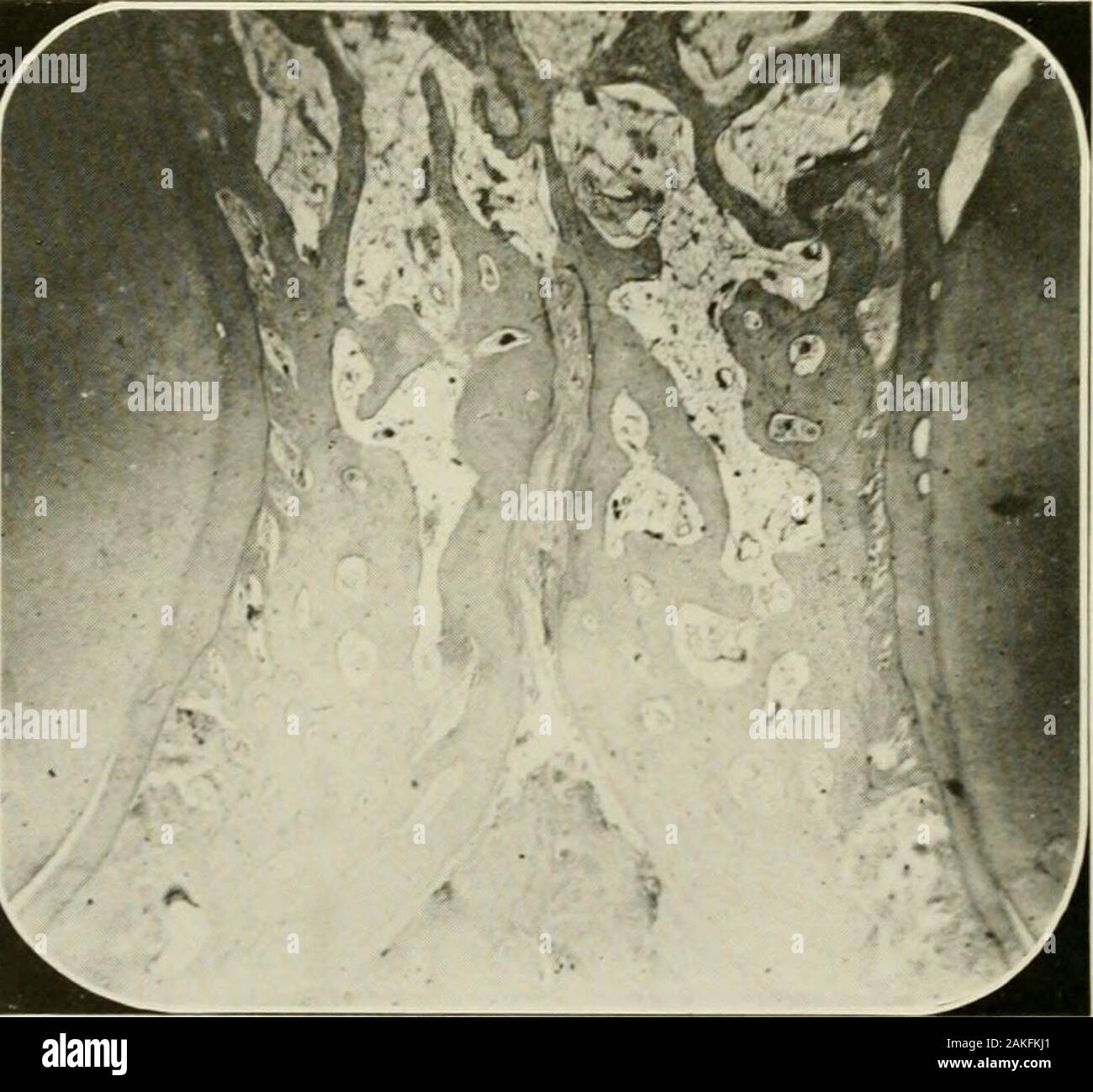 General and dental pathology with special reference to etiology and ...