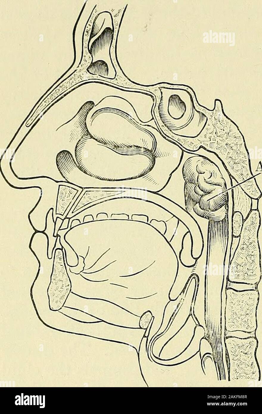 A manual of modern surgery : an exposition of the accepted doctrines ...