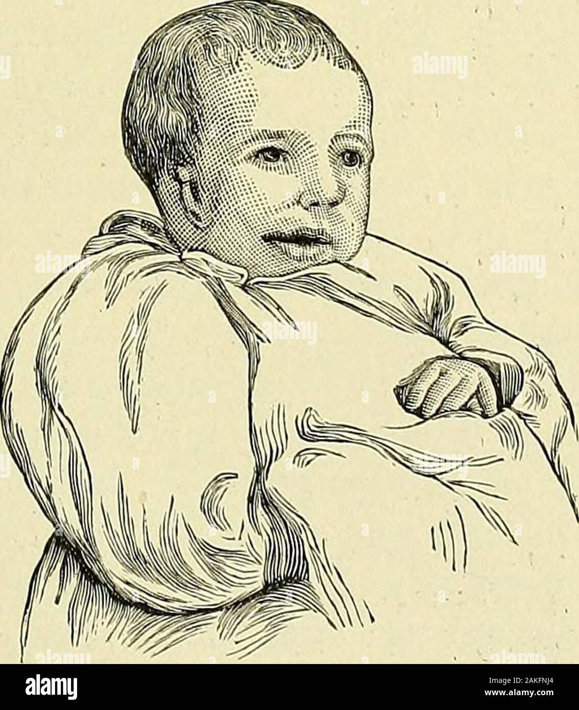 Separated lip hi-res stock photography and images - Alamy