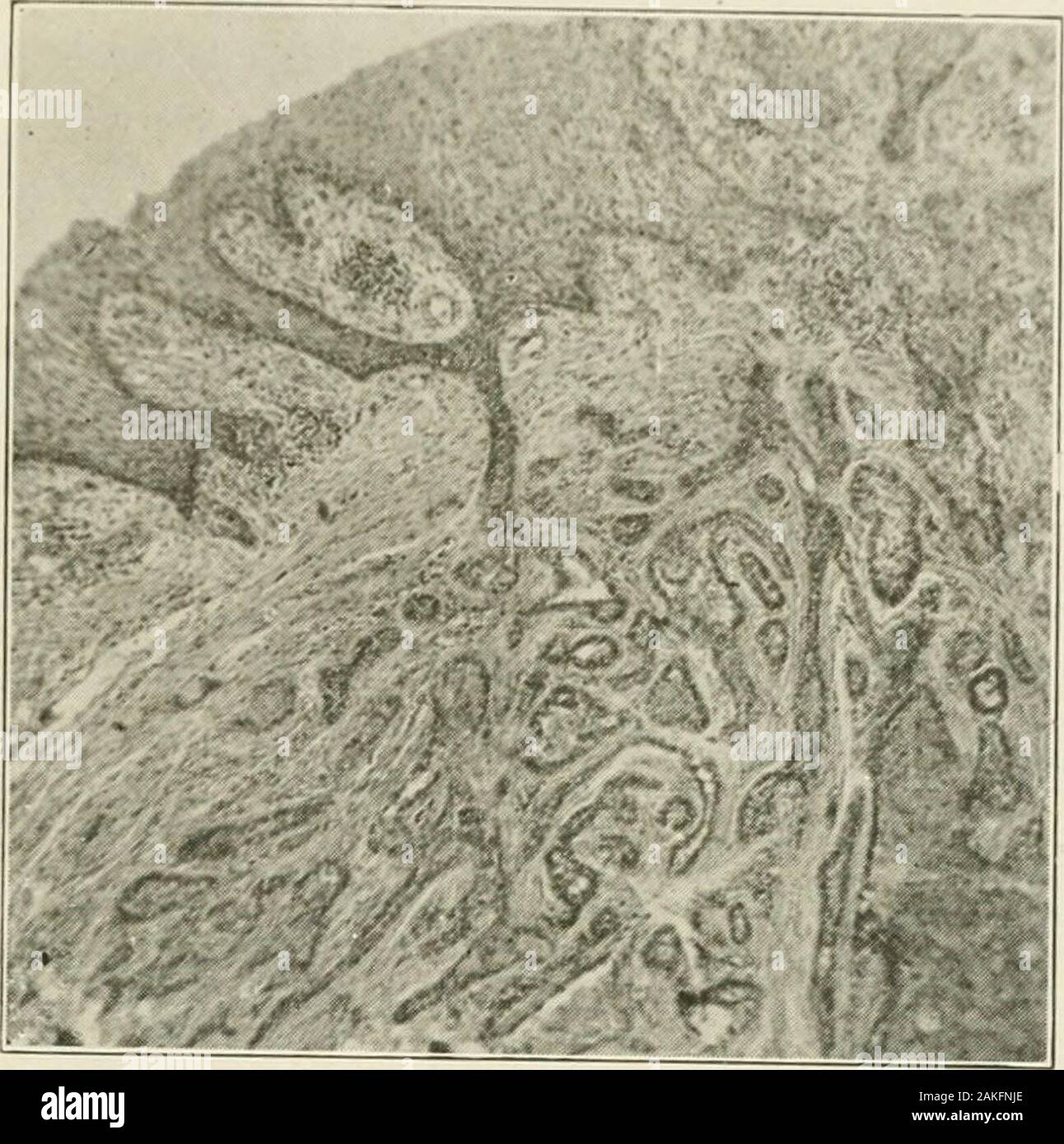 General and dental pathology with special reference to etiology and ...