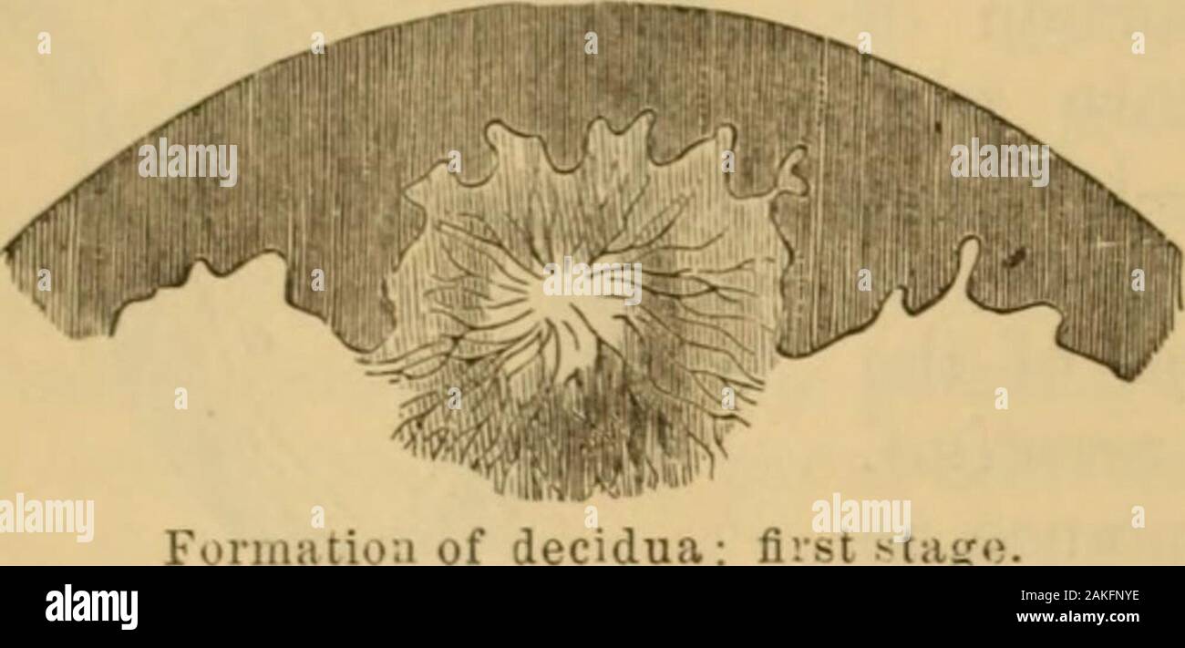 Decidua reflexa hi-res stock photography and images - Alamy