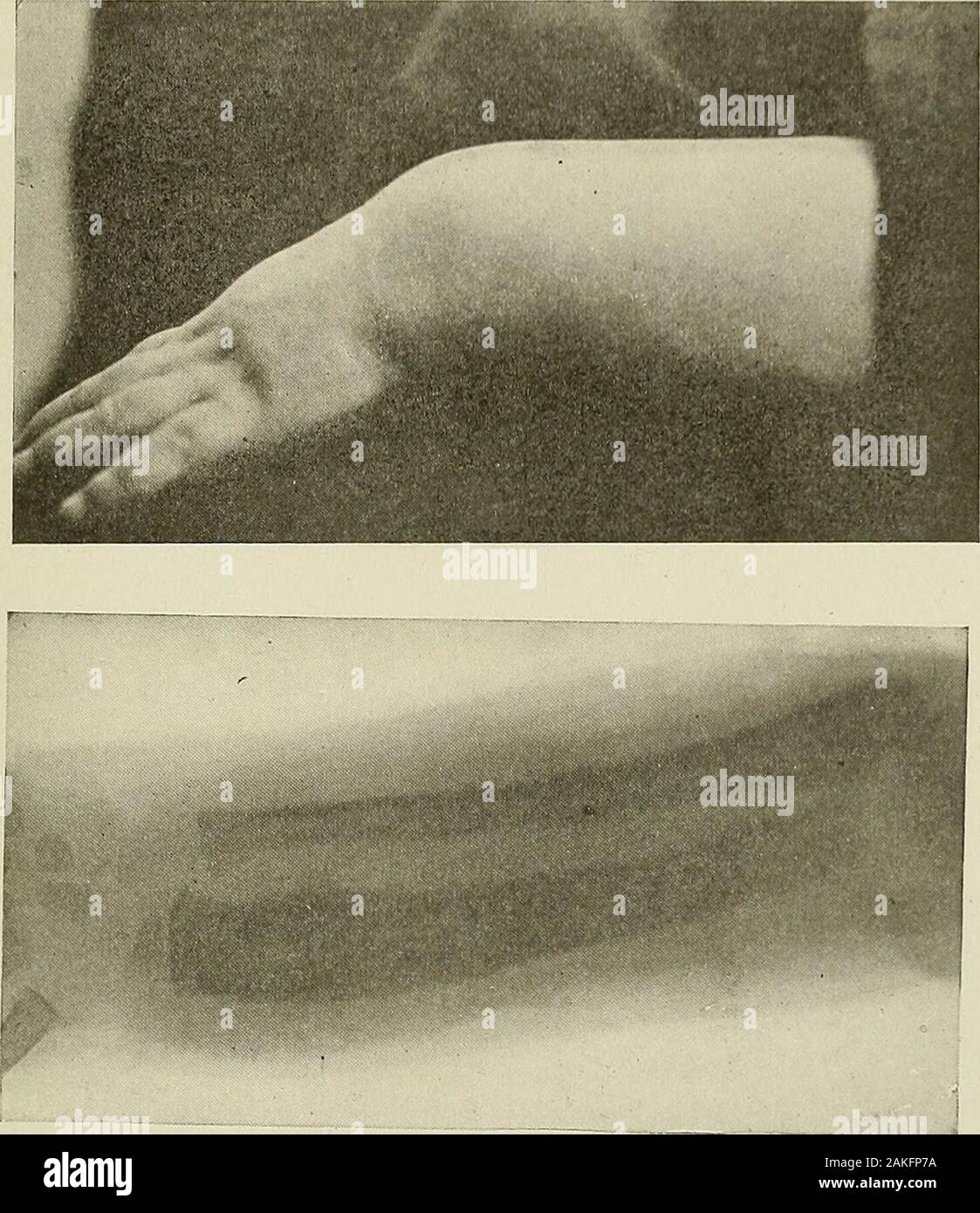 Pediatrics : the hygienic and medical treatment of children . ent ...