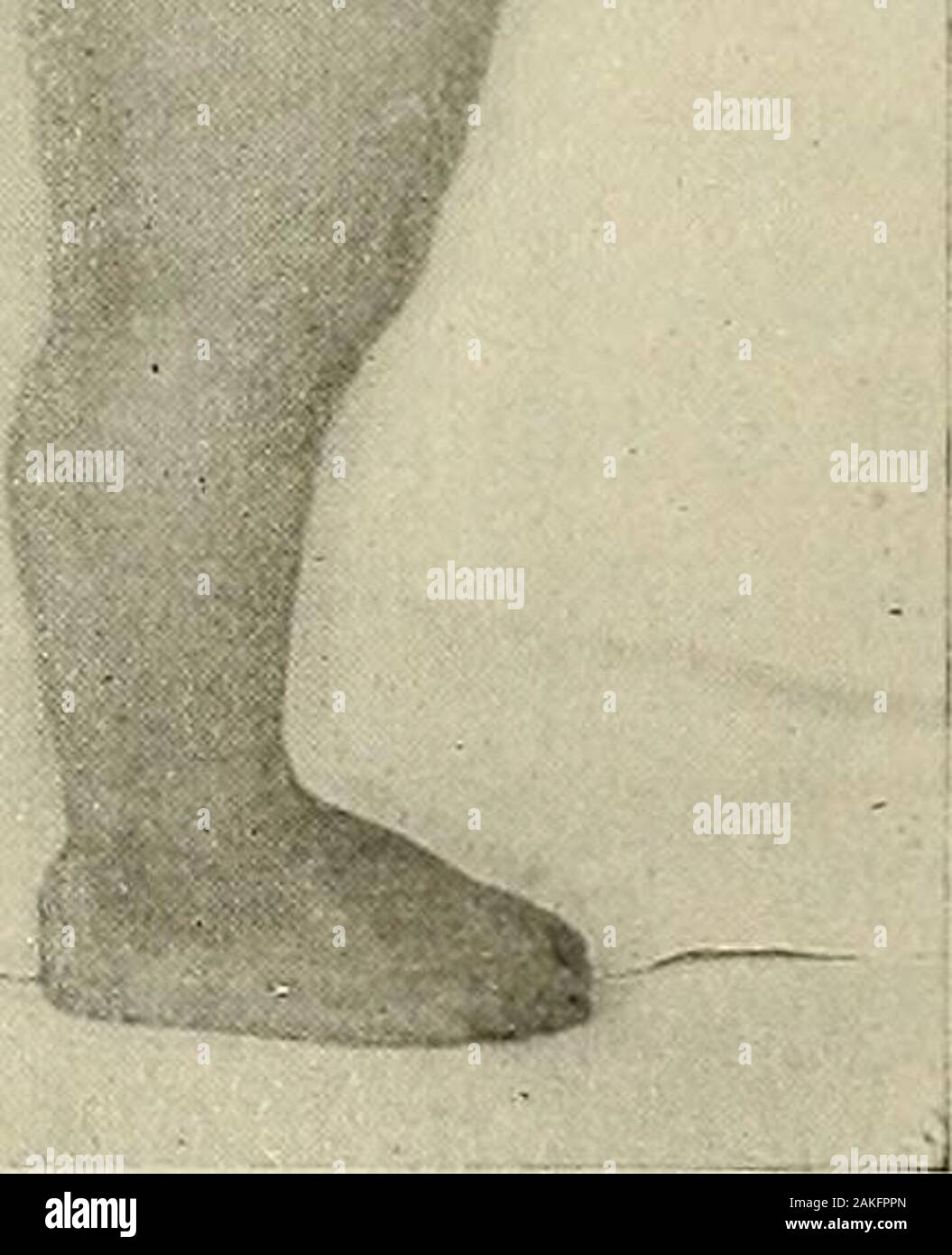 Pediatrics : the hygienic and medical treatment of children . J ...