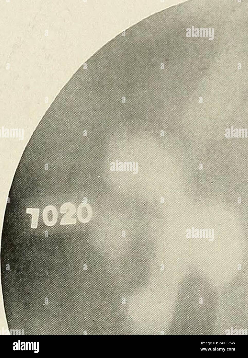 Pyelography (pyelo-ureterography) a study of the normal and pathologic ...