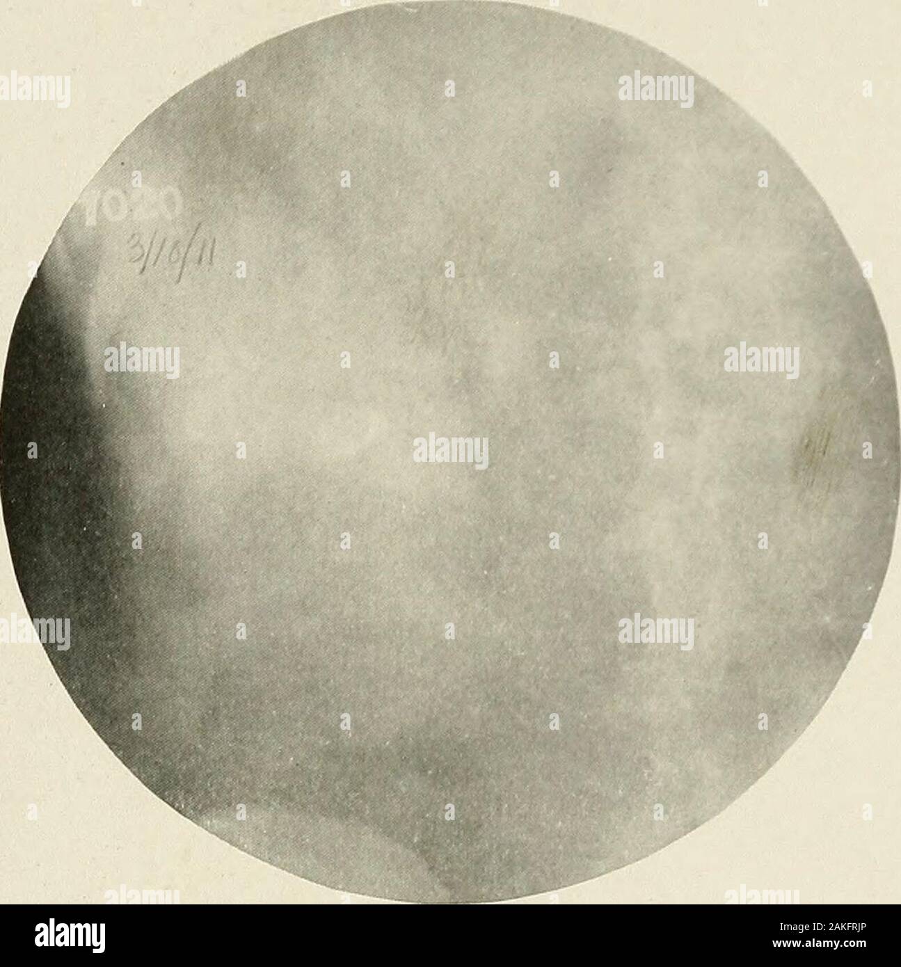 Pyelography (pyelo-ureterography) a study of the normal and pathologic ...