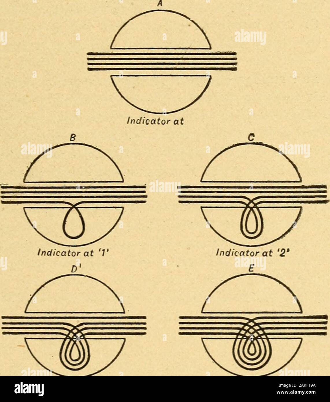 Stertor hi-res stock photography and images - Alamy