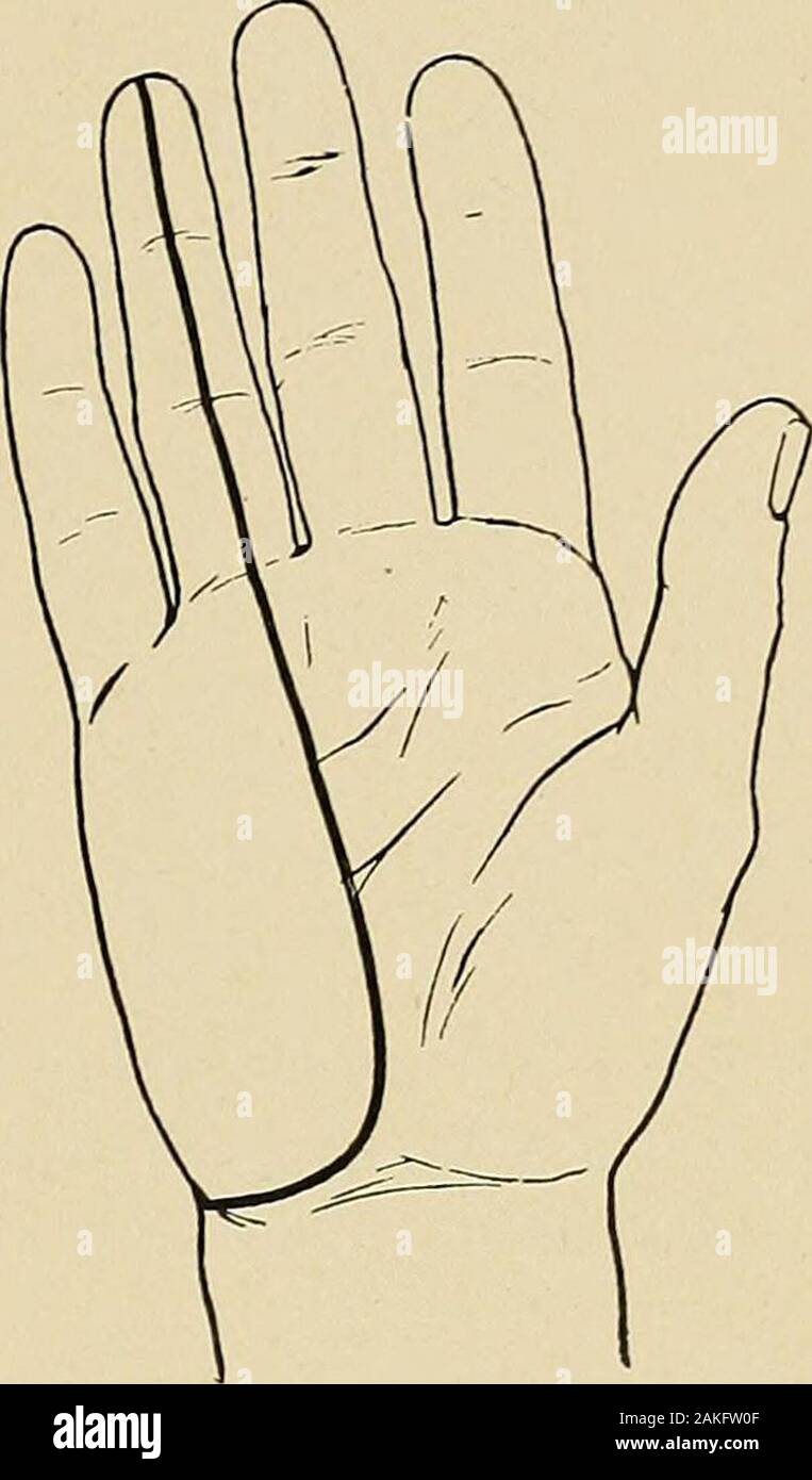 Diseases of the nervous system : a text-book of neurology and ...