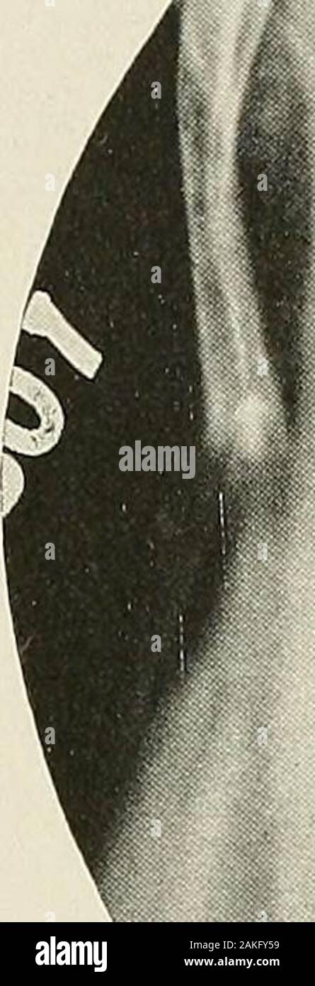 Pyelography (pyelo-ureterography) a study of the normal and pathologic ...