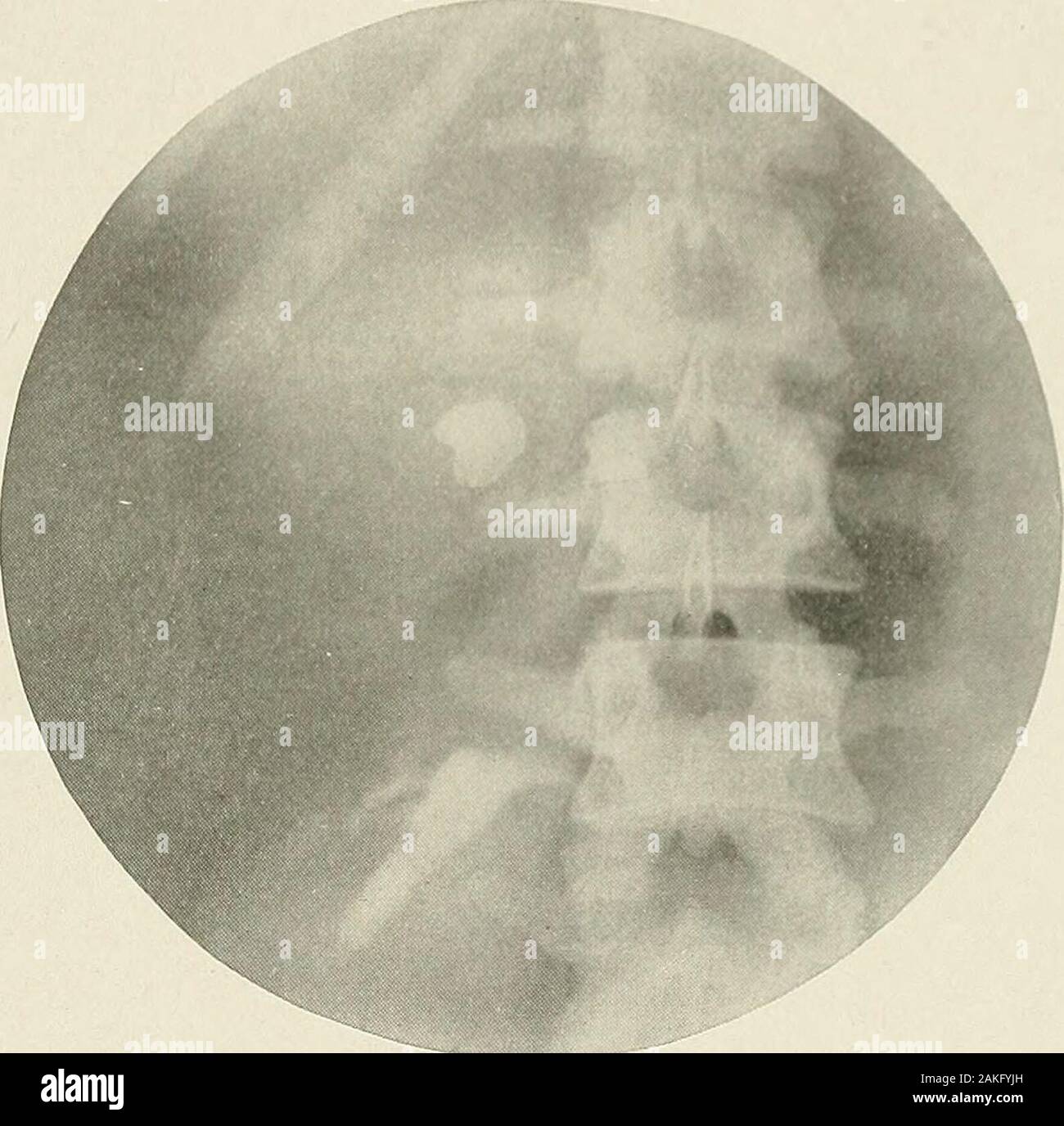 Radiographic anatomy hi-res stock photography and images - Alamy