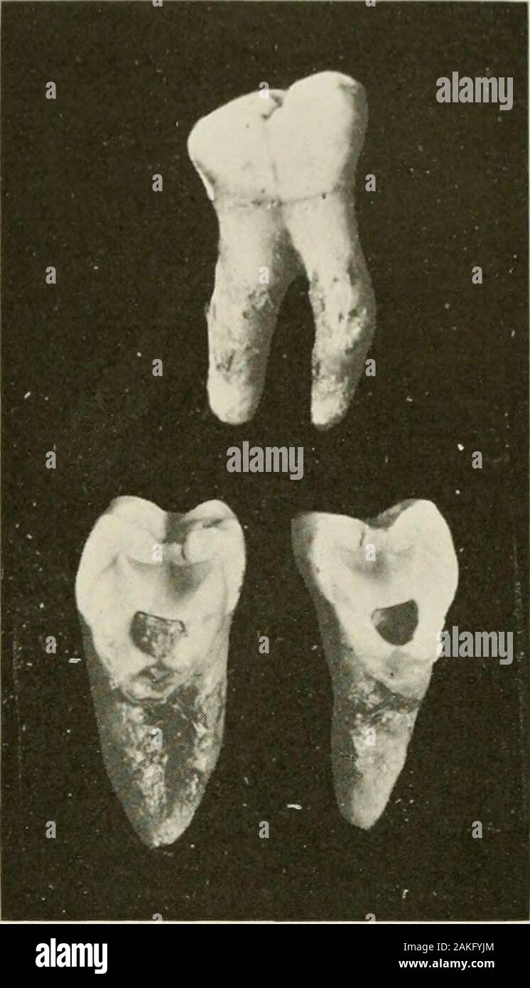 Pulp stones hi-res stock photography and images - Alamy