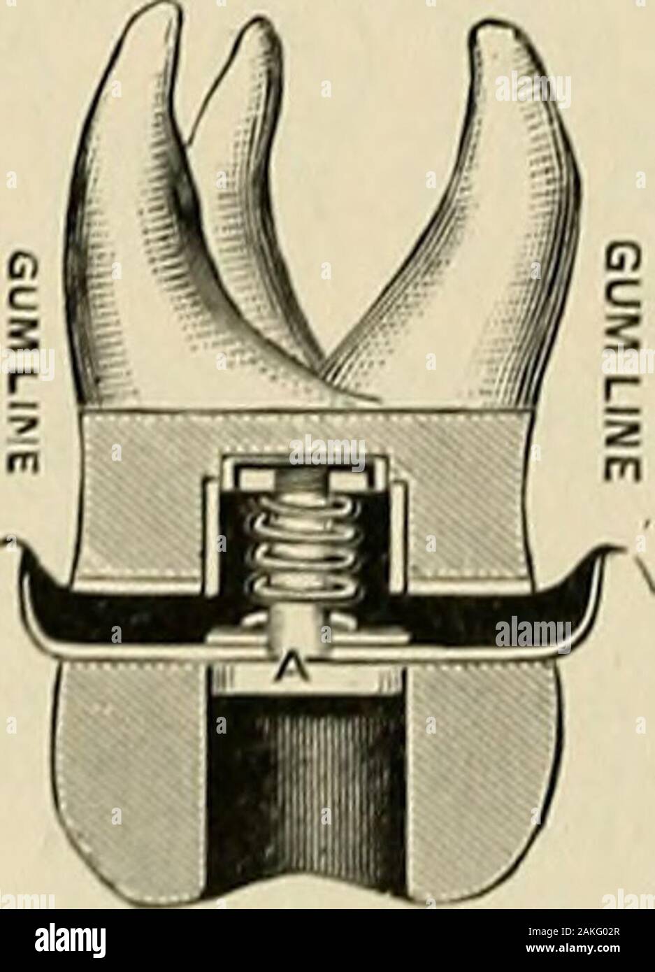 A practical treatise on mechanical dentistry . Straight ...
